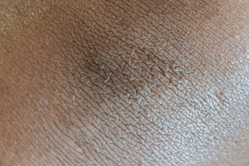 Skin Analysis: How Do Hormones Affect Your Skin? - Glassified Skin